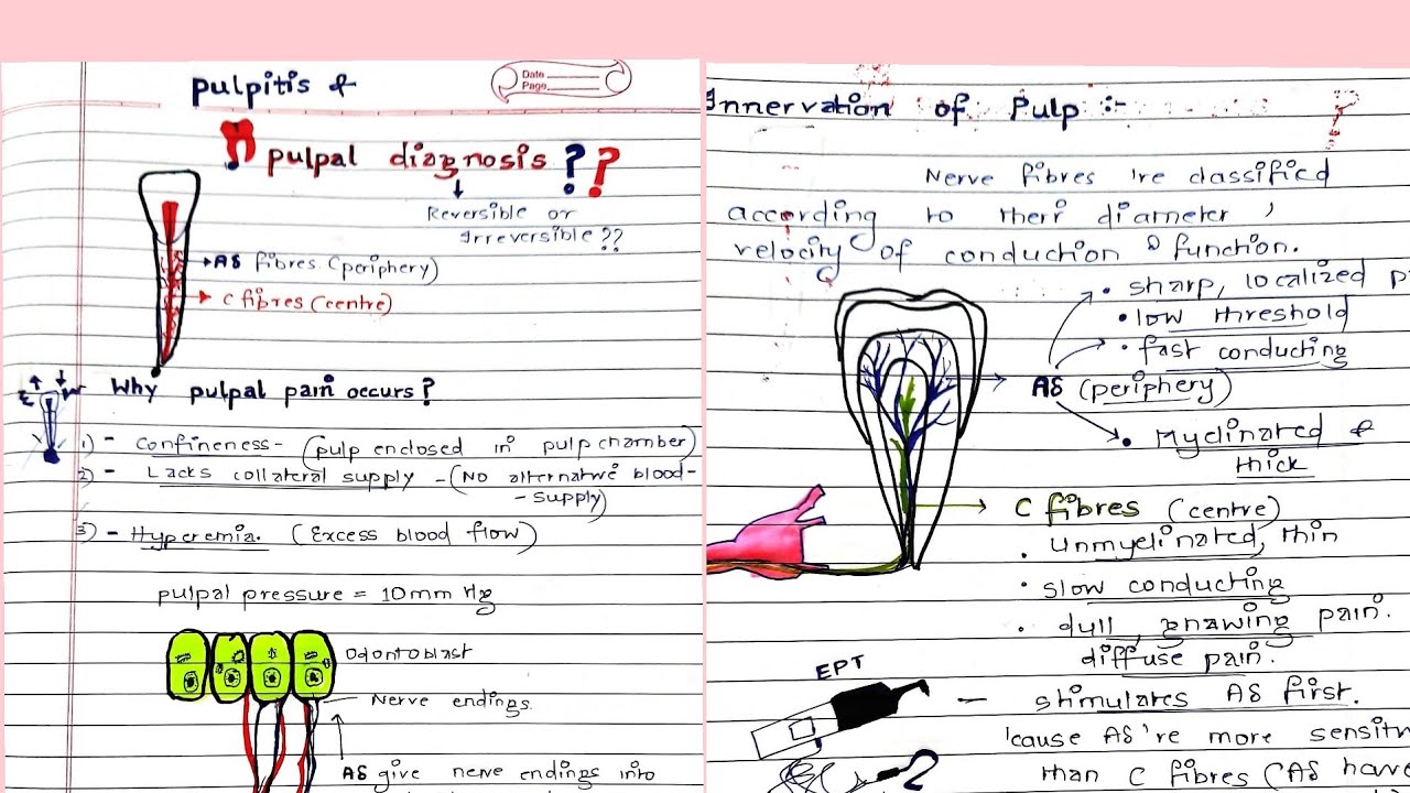 Pulpitis|| Reversible or Irreversible?? Pulpal diseases - YouTube