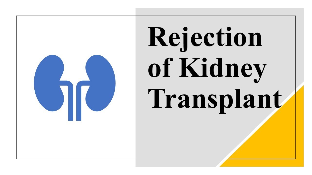 Rejection of Kidney Transplant - YouTube