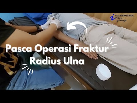 Latihan pasca operasi tulang radius ulna - YouTube