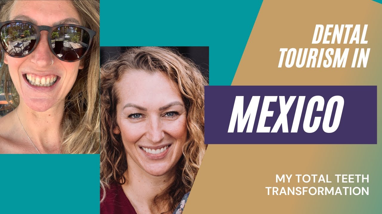 Dental Tourism In Mexico | Total Teeth Transformation - YouTube