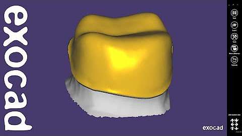exocad DentalCAD TRAINING Playlist - YouTube
