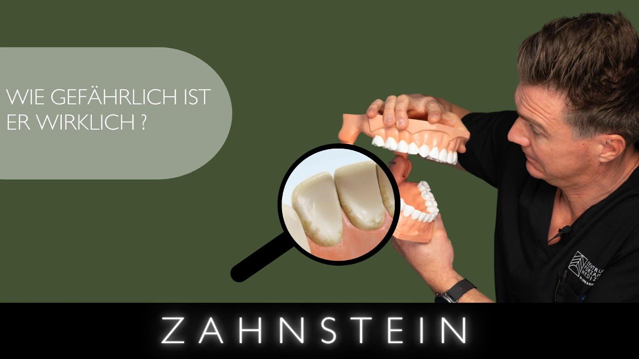 Zahnstein - ist er gefährlich ? Wie entsteht er ? Wie oft muss er weg ...