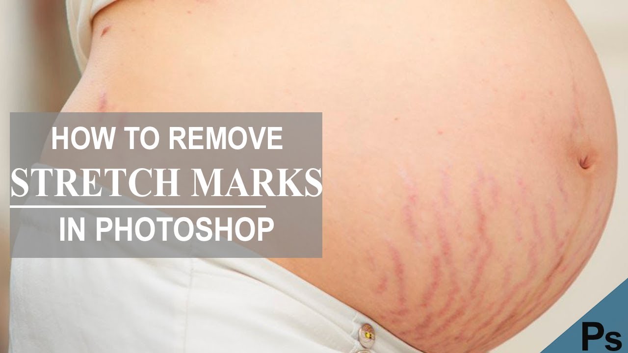 How To Remove Stretch Marks In Photoshop YouTube how-to-remove-stretch-marks-in-photoshop-youtube