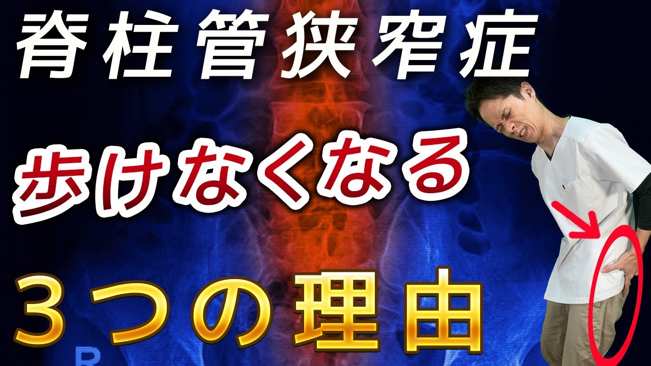 【脊柱管狭窄症の治し方】絶対やってはいけないこと【腰部脊柱管狭窄症ストレッチ】 Youtube