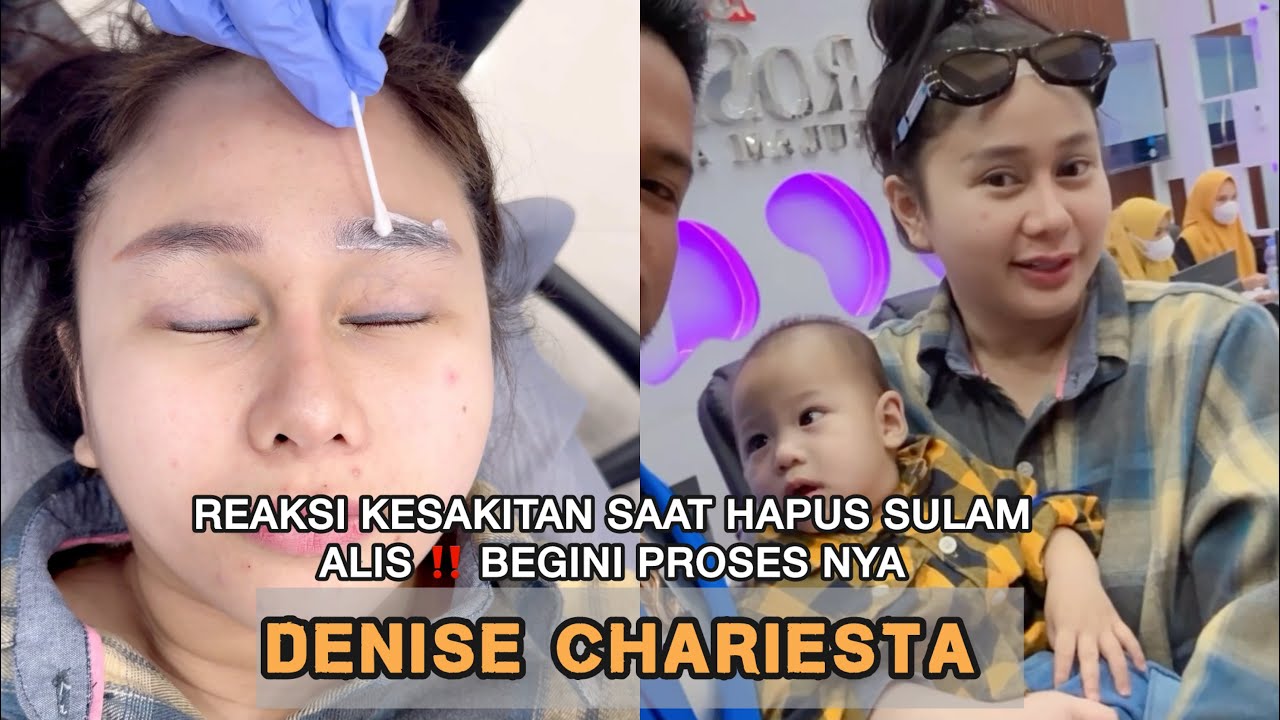 FULL VIDEO ‼️ DENISE CHARIESTA HAPUS SULAM ALIS KESAKITAN 🧑🏿‍🦰 - YouTube