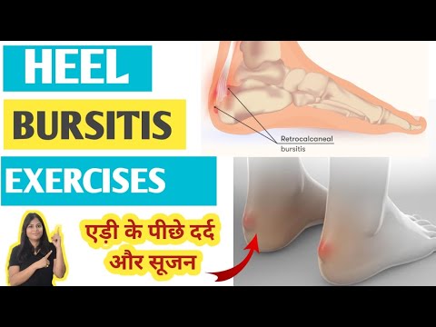 Heel bursitis exercises | Retrocalcaneal bursitis | एड़ी के पीछे दर्द ...