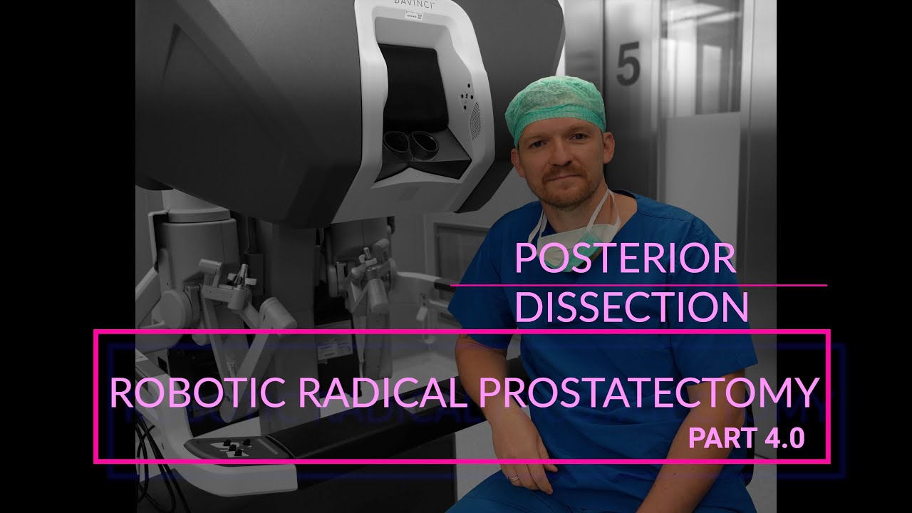 Robotic (Da Vinci) Radical Prostatectomy / Part 4 / Posterior ...