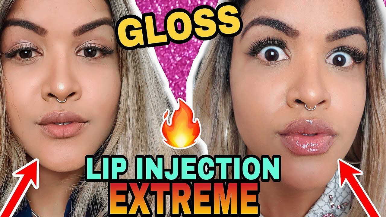AUMENTANDO A BOCA COM LIP INJECTION | Preenchimento - YouTube