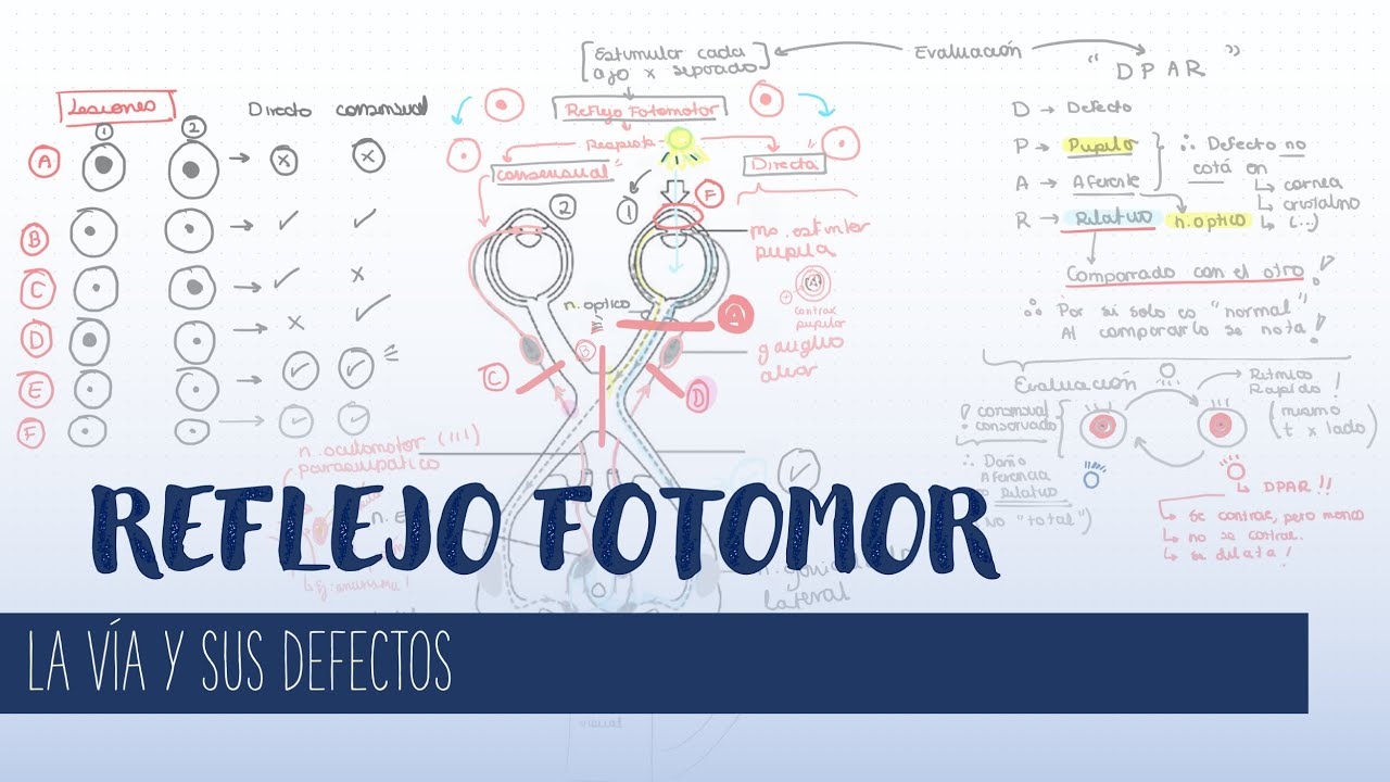 REFLEJO FOTOMOTOR y DPAR:Defecto Pupilar Aferente Relativo # ...