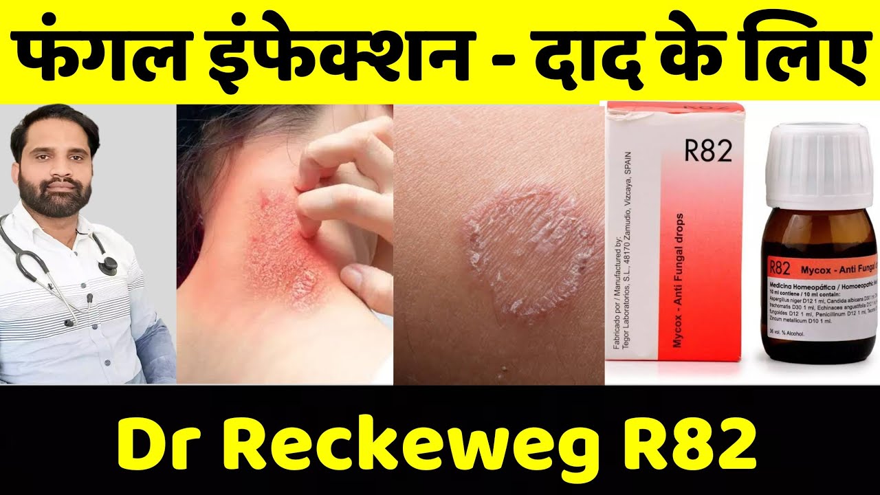Dr Reckeweg R82 in hindi | Dr Reckeweg R82 review | R82 homeopathic ...