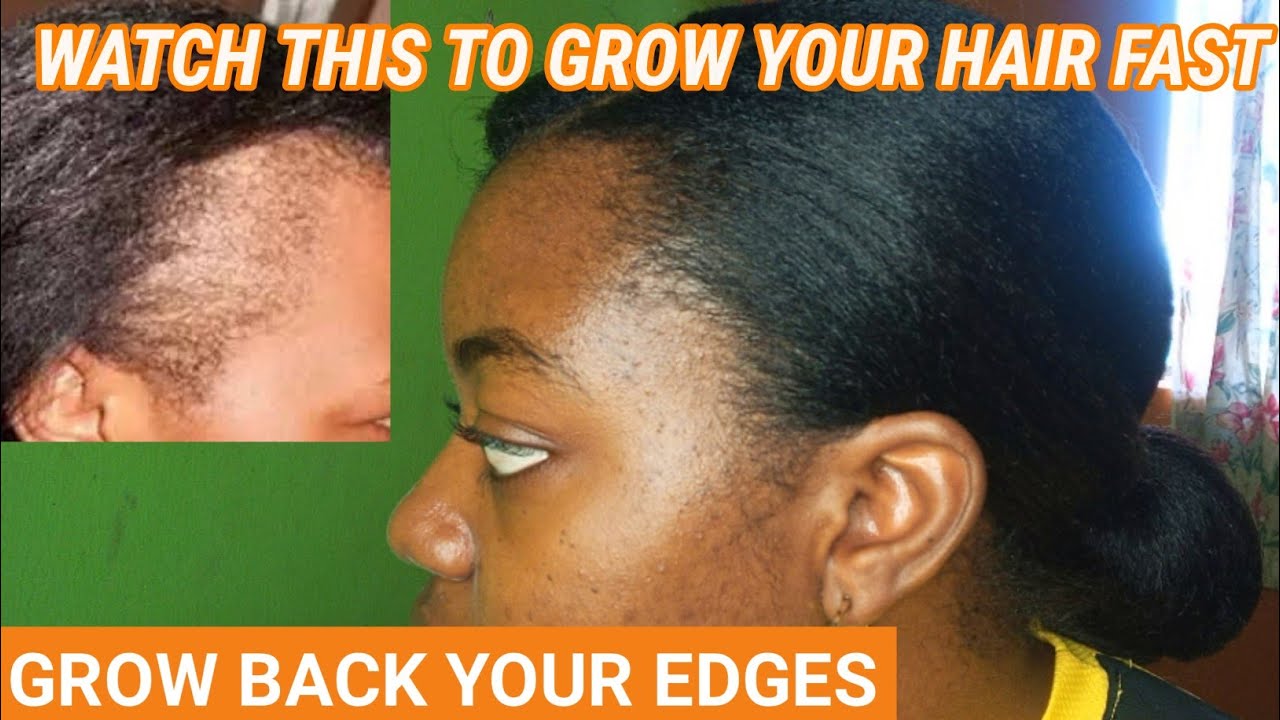 WATCH THIS TO GROW BACK YOUR EDGES FAST | TIPS FOR HAIR LOSS | RELAXED ...