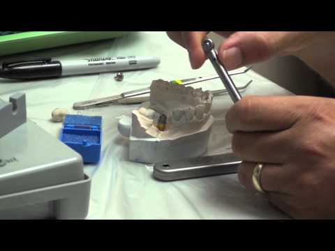 Implant Crown Delivery Part 3 - YouTube