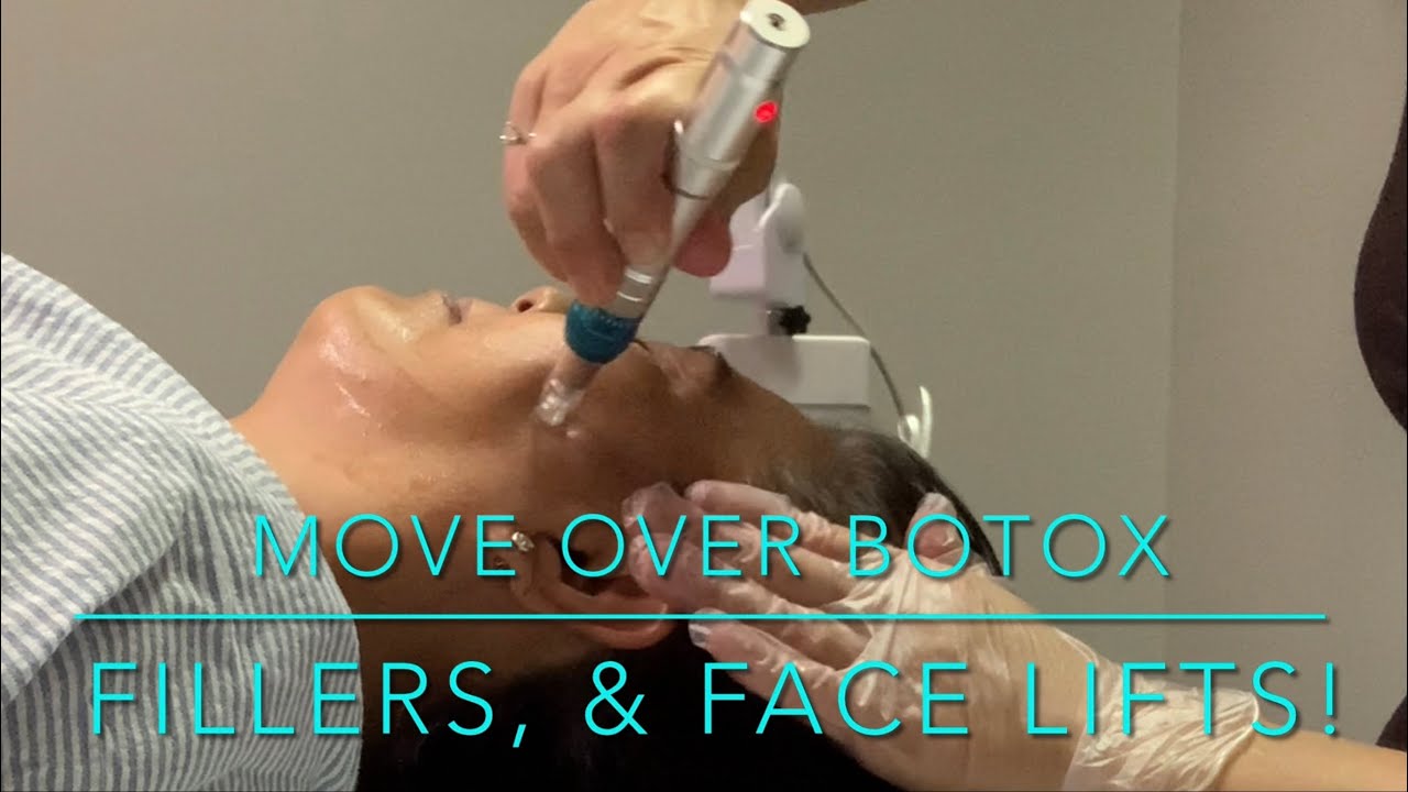 🌟Microneedling for Youthful Skin | Anti-Aging, Sagging Skin & Collagen Boost Therapy, Lake Mary ...