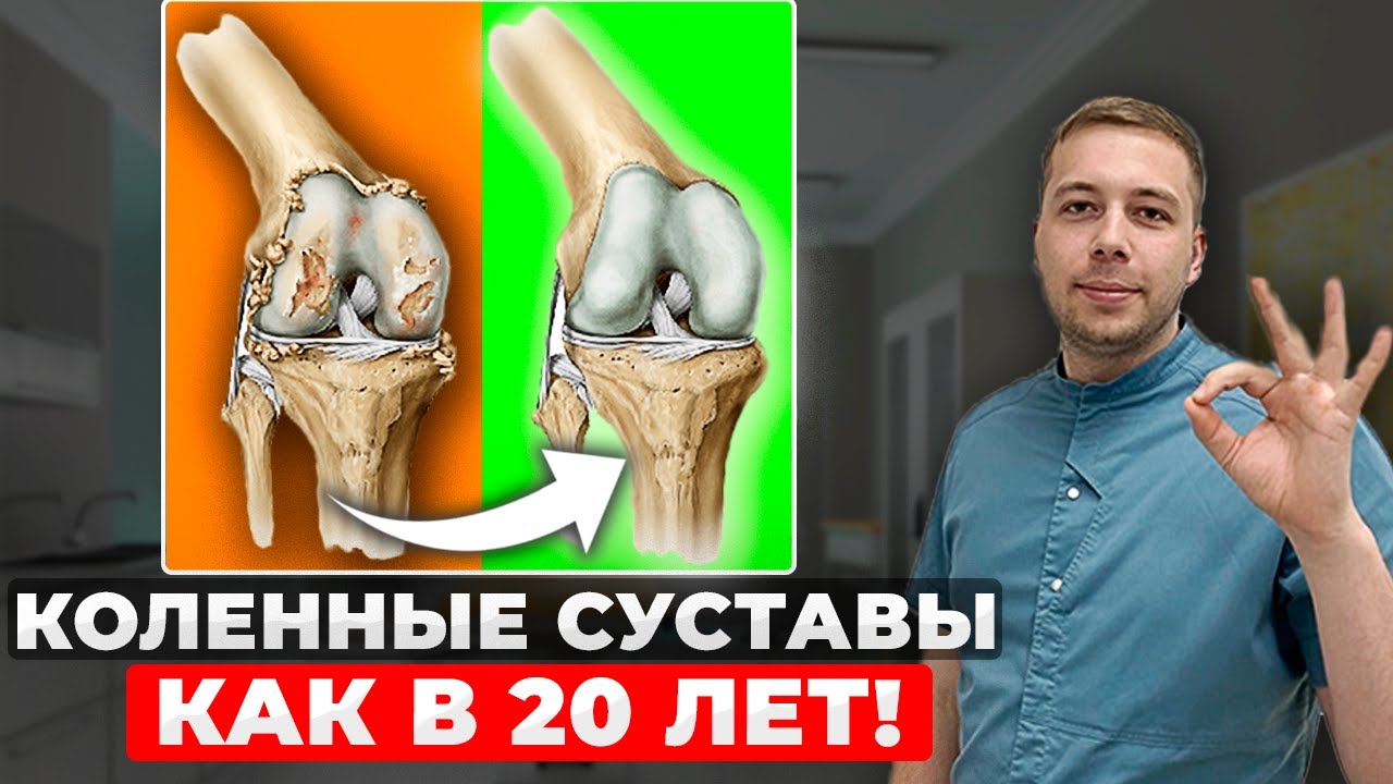 ГЛАВНЫЙ СЕКРЕТ здоровых КОЛЕНЕЙ Как вылечить коленные суставы в