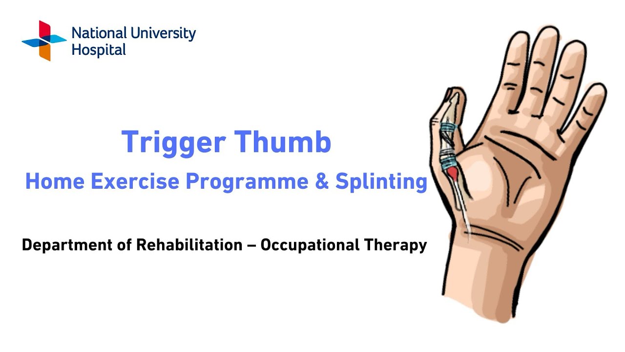 Management of Trigger Thumb (Home Exercise Programme and Splinting ...
