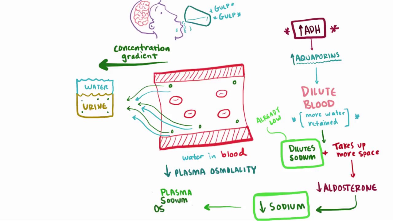 Syndrome of inappropriate antidiuretic hormone SIADH - YouTube