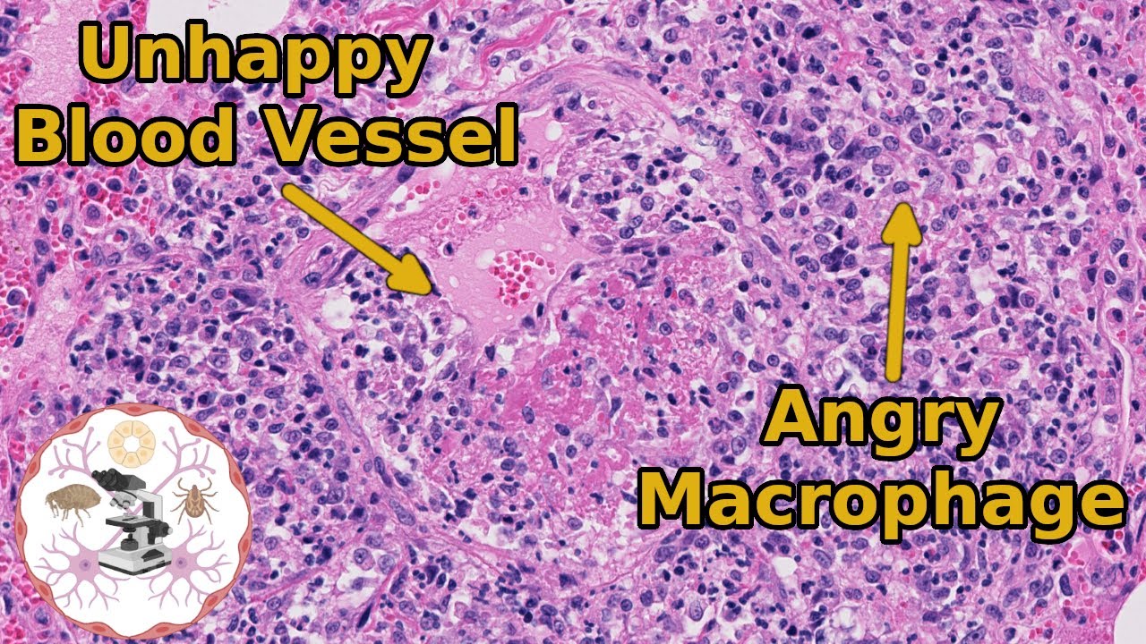 What's the Diagnosis? 2 - Tissue from a Cat - YouTube