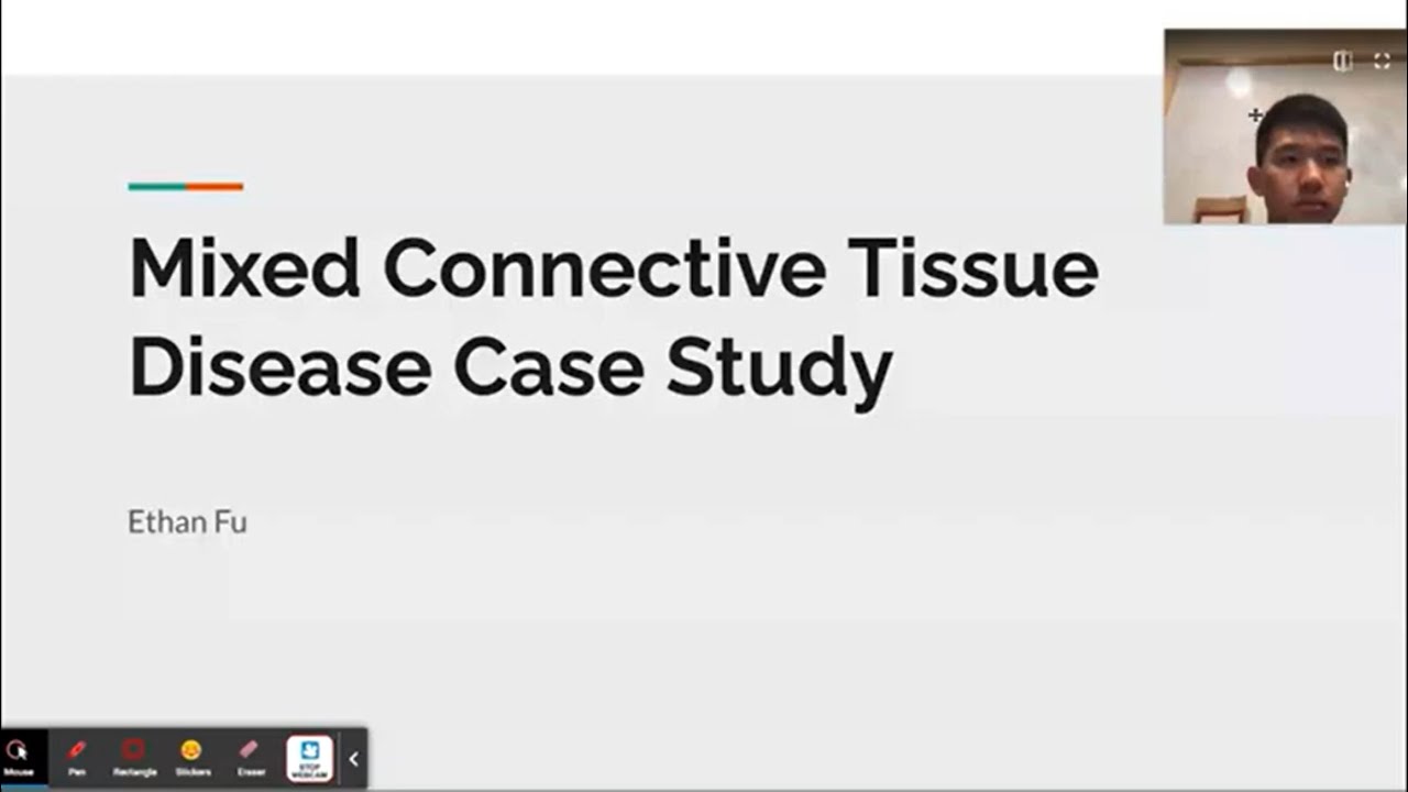Mixed Connective Tissue Disease Case Study - Eureka Student Research - YouTube