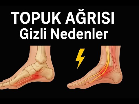 Ayağınızda Yanma ve Ağrı Varsa Dikkat! Tarsal Tünel Sendromu ve Topuk Dikeni Olabilir