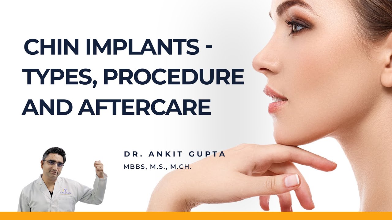 Chin Implants - Types of Chin Implants, Surgery Method, Procedure ...