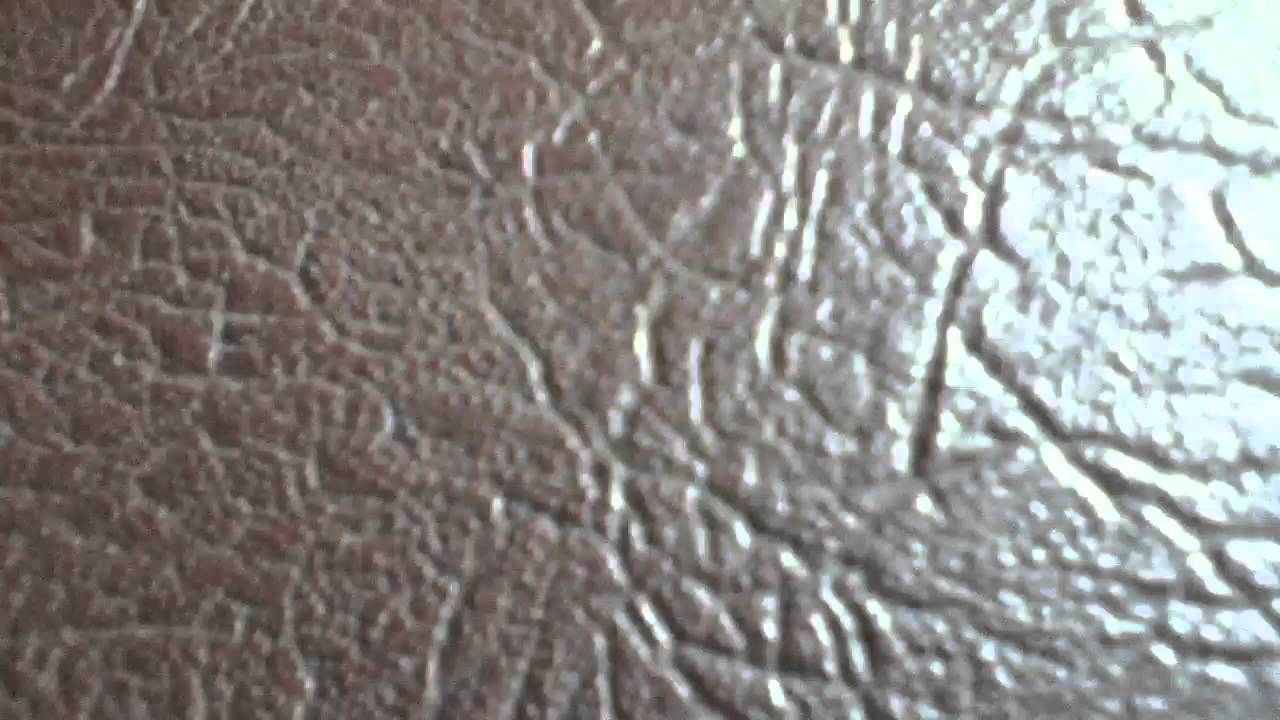My Knee Grows! - YouTube