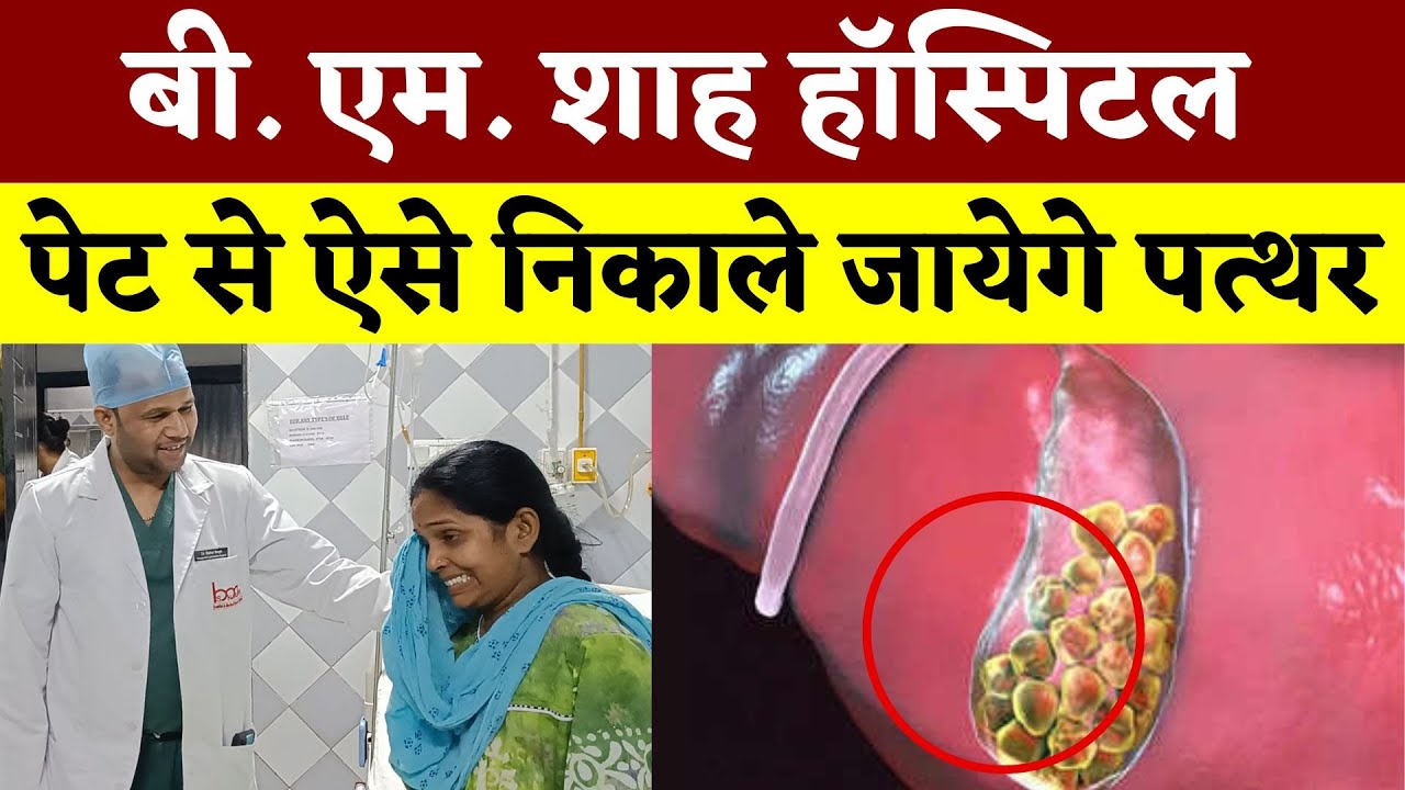 BM.Shah Hospital पेट से ऐसे निकाले जायेंगे पत्थर || KP NEWS || - YouTube