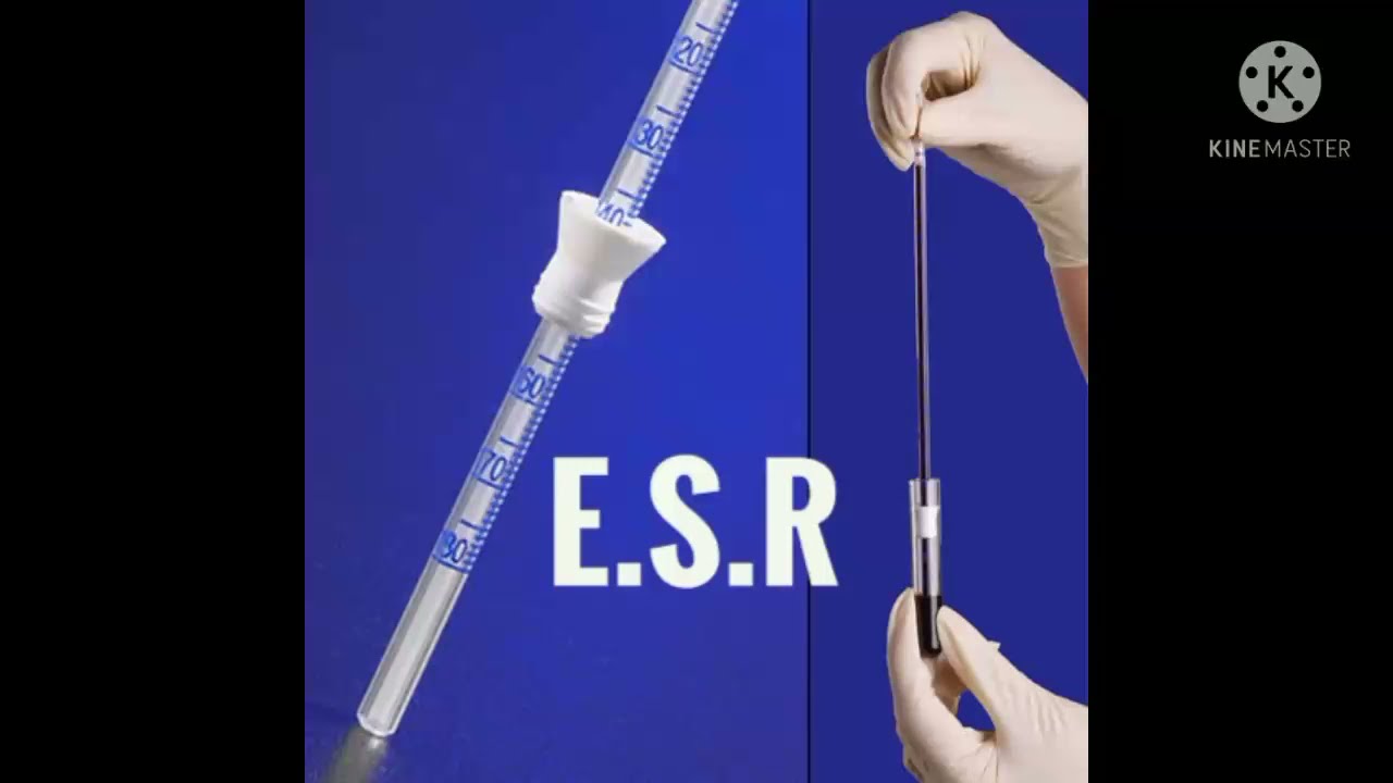 erythrocyte sedimentation rate (ESR or sed rate) test - YouTube