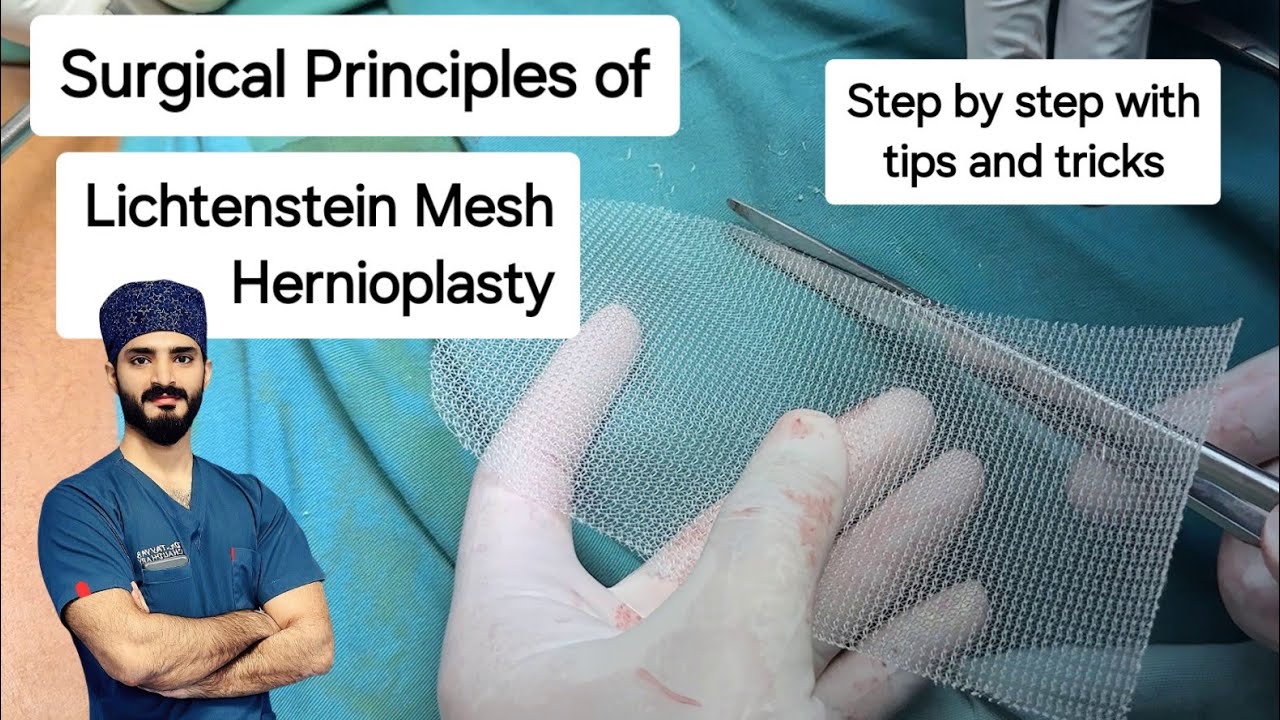 Inguinal Hernia | Surgical Principles of Lichtenstein Repair - Dr ...