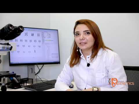 Turner sindromu nədir? - Fetal Mərkəz NS Genetics klinikası