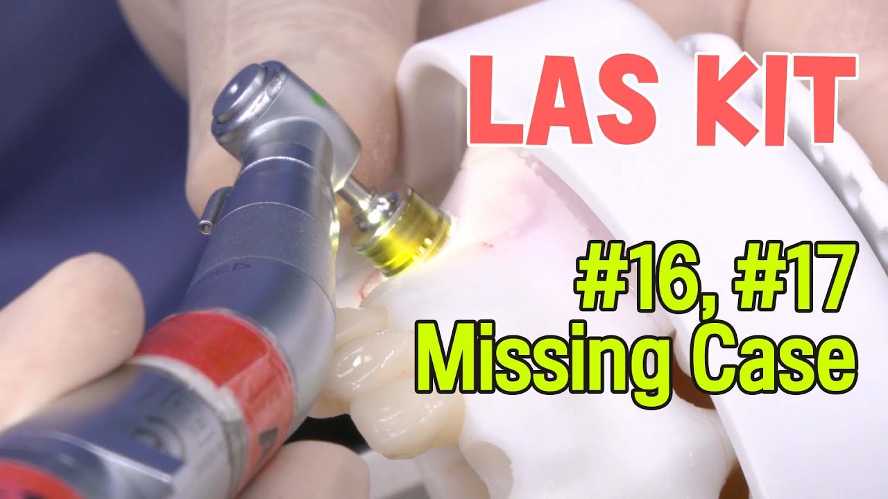 [EASY Hands-on] LAS KIT - #16, #17 Missing Case - YouTube