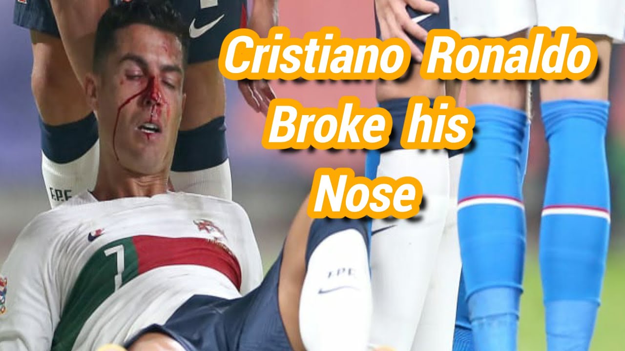 Cristiano Ronaldo's Broken Nose Injury | Czech Republic Vs Portugal 24 ...