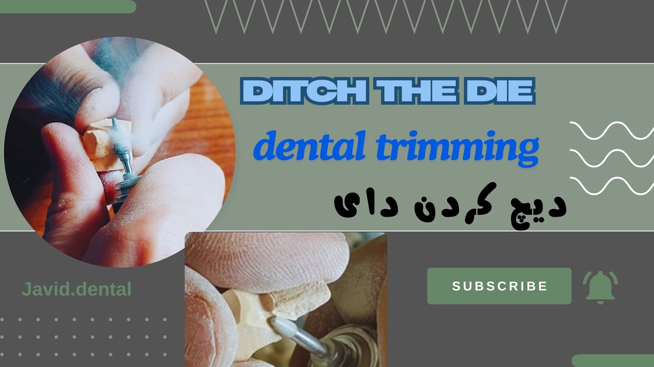 دیچ کردن دای/ چقدر دیچ کنیم؟ / dental trimming / ditch the die - YouTube