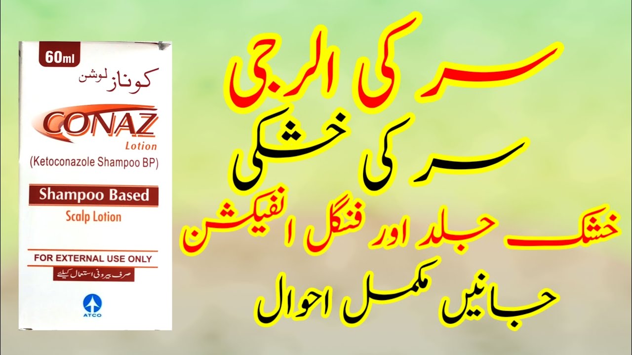Conaz Lotion Uses in Urdu / Conaz Lotion Shampoo Based Benefits and ...