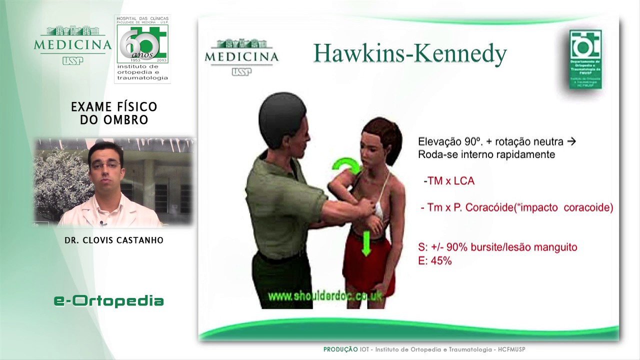 Exame Físico do Ombro - Dr. Clóvis Castanho - YouTube