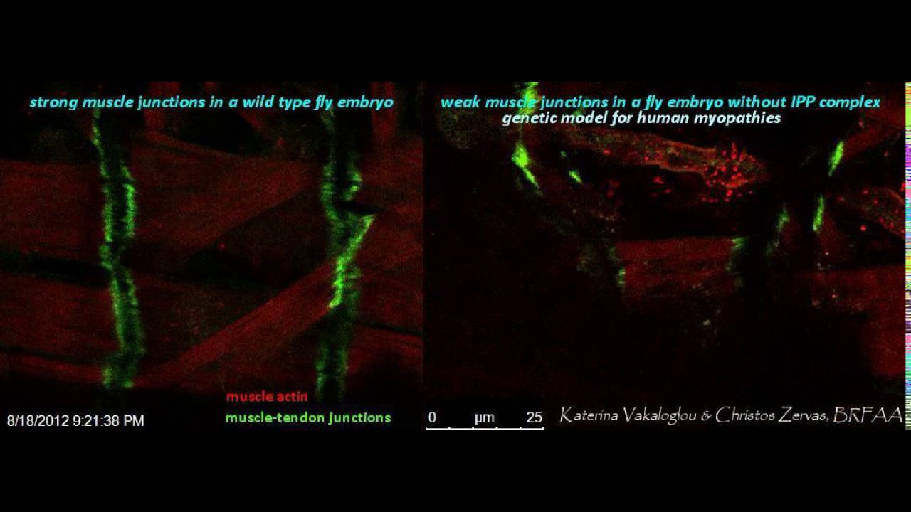 IPP Complex Reinforces Adhesion by Relaying Tension-Dependent Signals ...