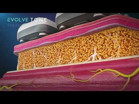 Tone | Non-Surgical Body Contouring | Dr. Maya Kato