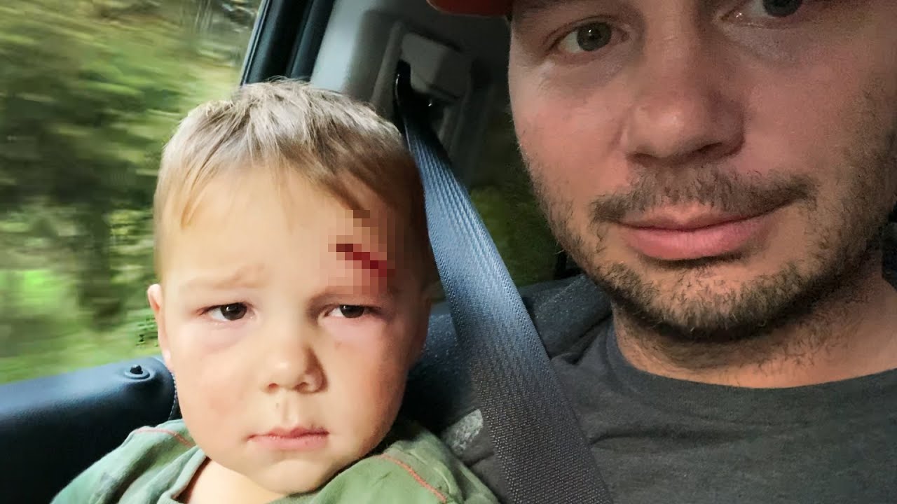 How Baby Jones Got His First Stitches - YouTube