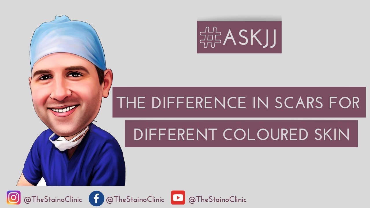 The difference in scars for different coloured skin - YouTube