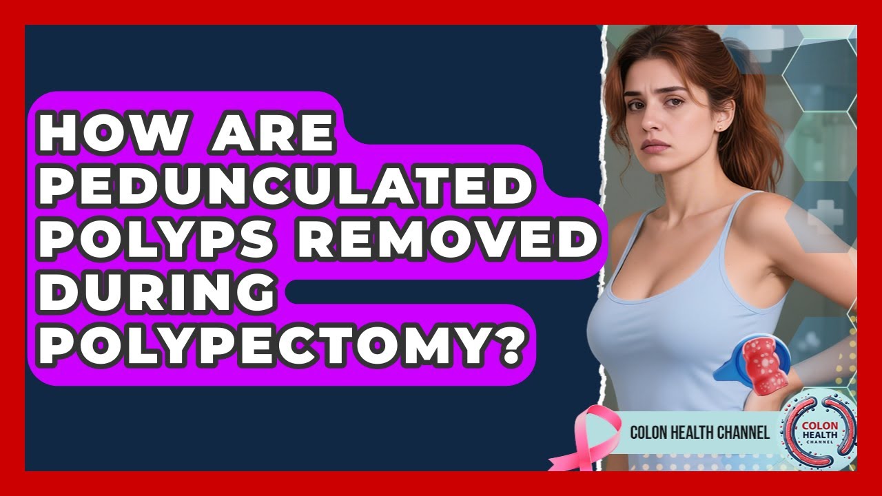 How Are Pedunculated Polyps Removed During Polypectomy? - Colon Health ...