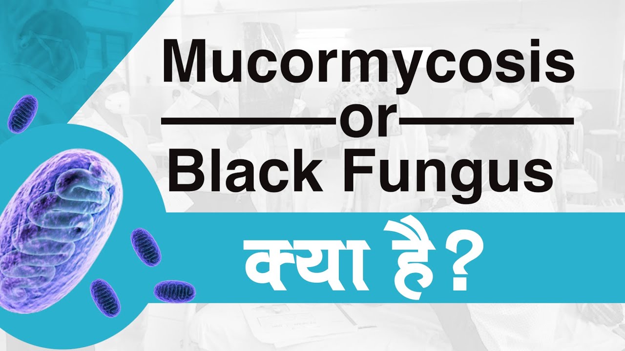 What is Mucormycosis? Know about the Symptoms, Prevention, and cause of ...