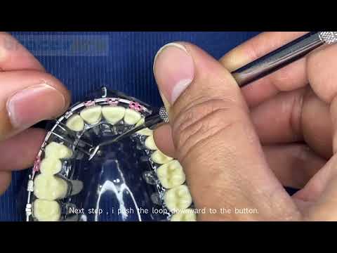 Preview clip Ep.10 Ballista loop - YouTube