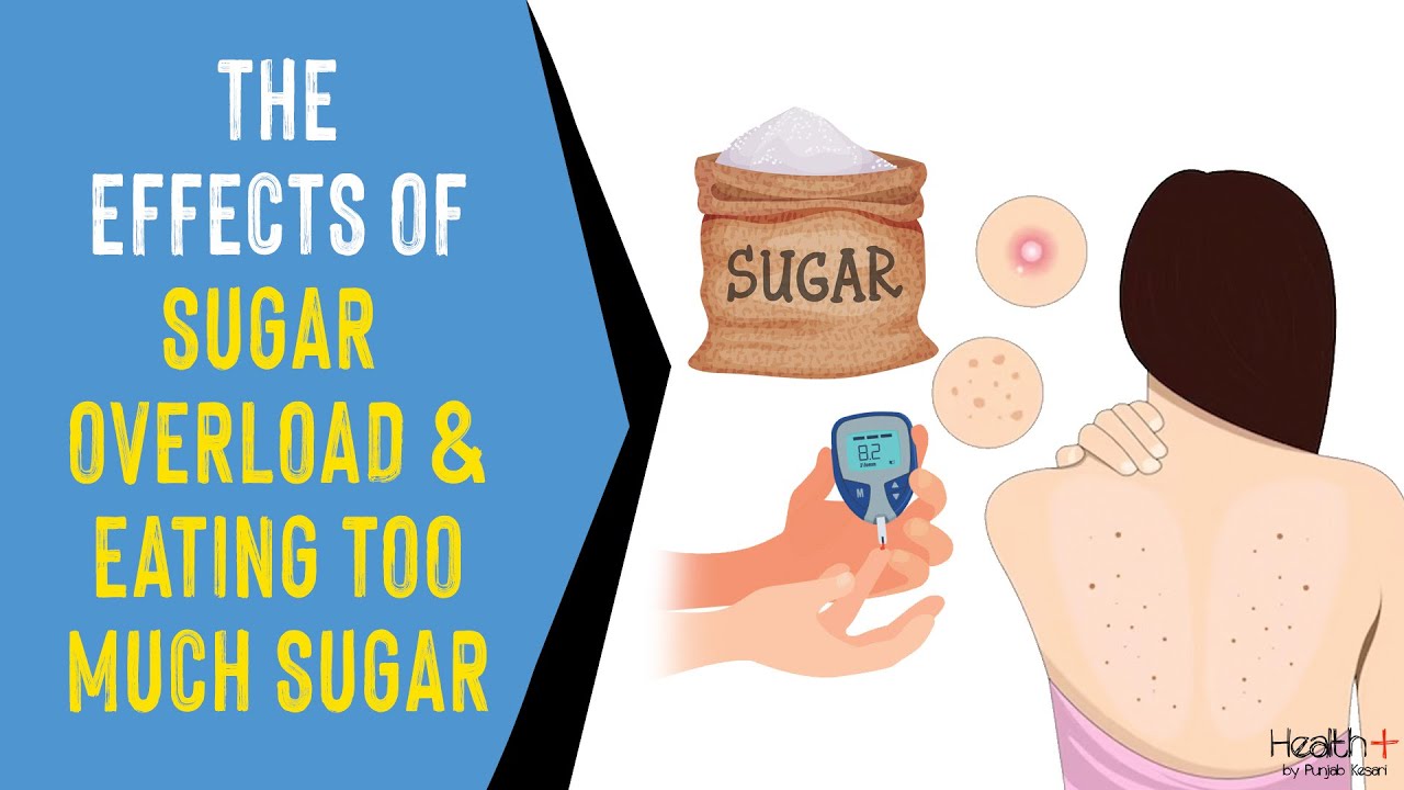 The Effects of Sugar Overload & Eating Too Much Sugar - YouTube