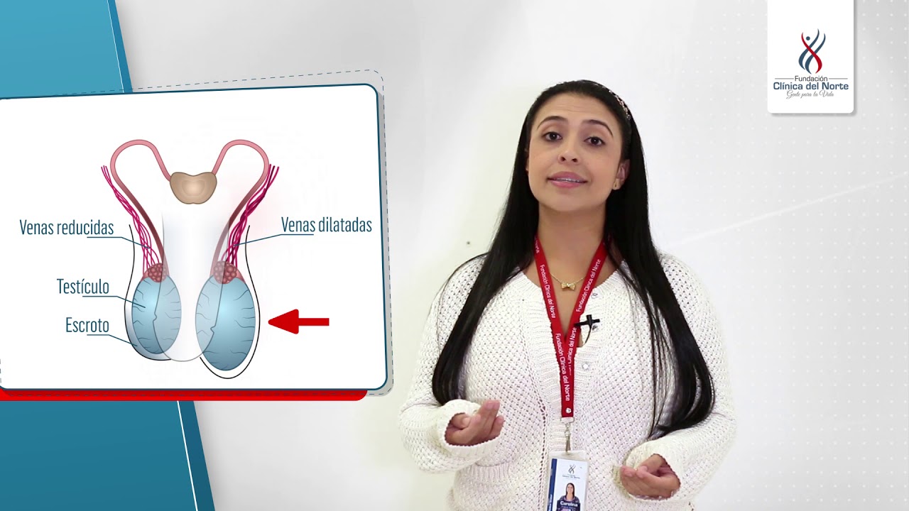 ¿Qué es varicocele? - YouTube