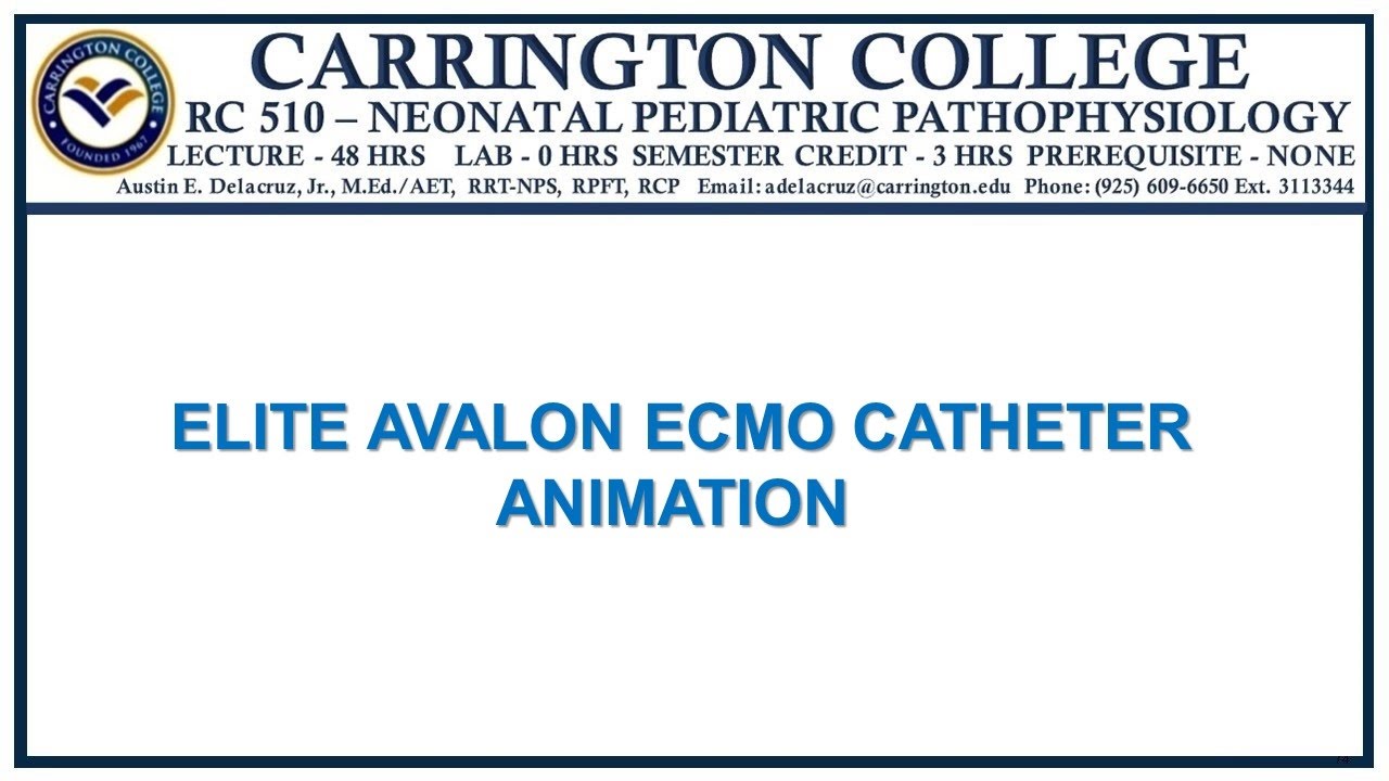 ELITE AVALON ECMO CATHETER - YouTube