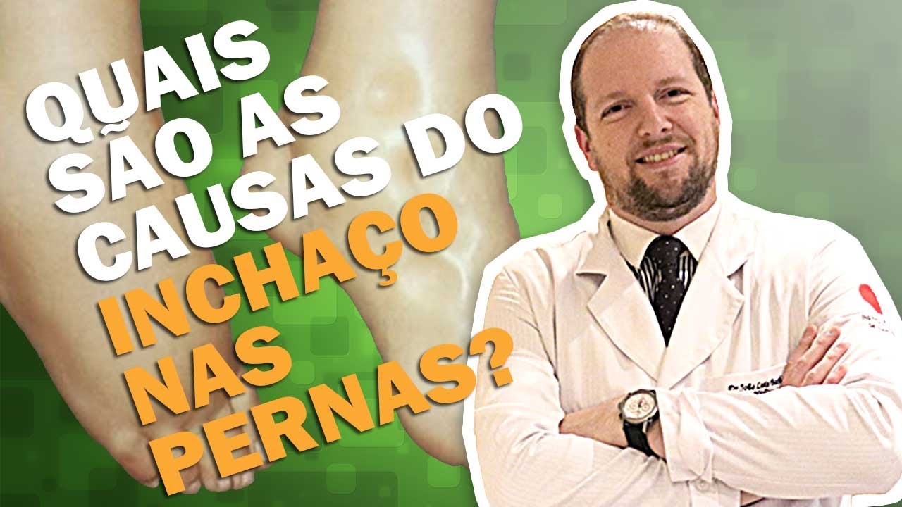 Quais são as causas do inchaço nas pernas? Quando o inchaço é benigno ...