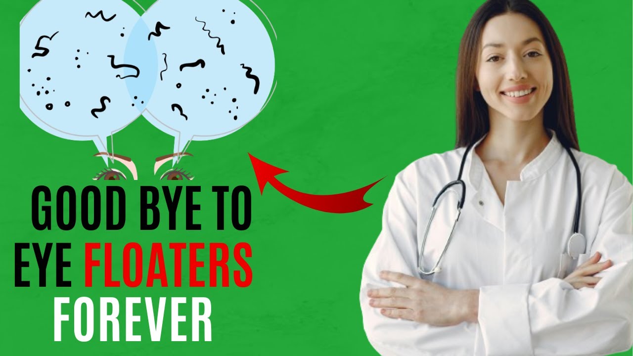 Natural Treatment For Eye Floaters | Say Goodbye to Eye Floaters FAST ...