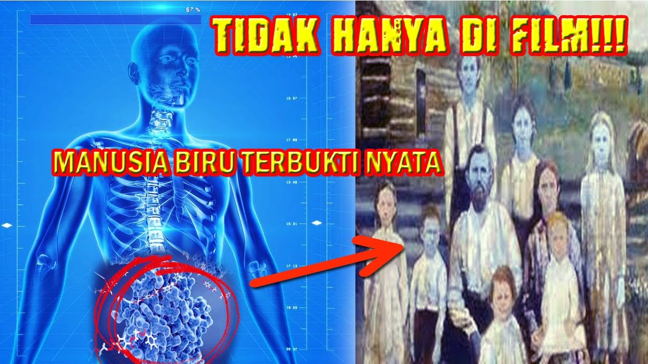 INI ANEH TAPI TERJADI..!!! KETURUNAN MANUSIA BERKULIT BIRU NYATA ADA ...