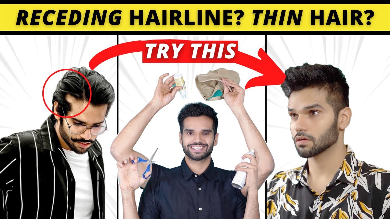 Receding Hairline ? Thin Hair Loss ? Big Forehead ? Try These CRAZY ...