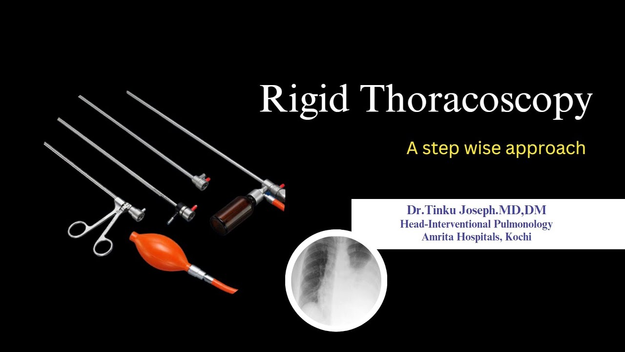 Rigid Thoracoscopy - A Step wise approach - YouTube