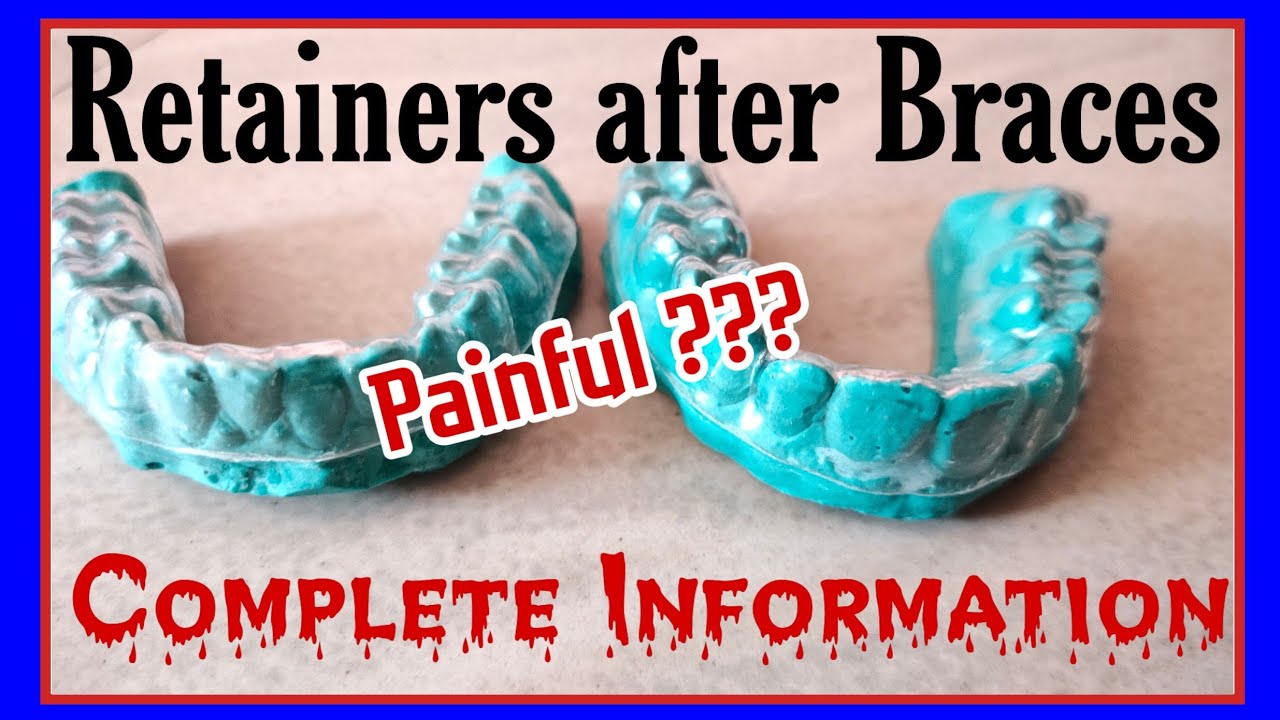 Are "RETAINERS" Painful?🤯All You Need To Know About Retainers|Full ...